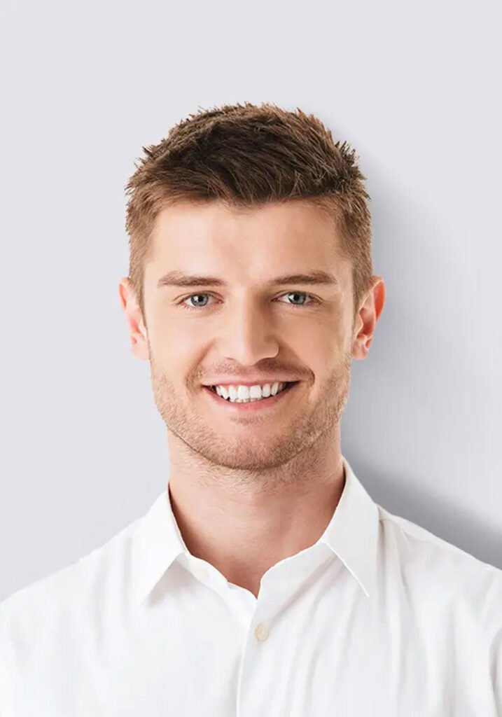 What are The Different Types of Hairlines for Men?