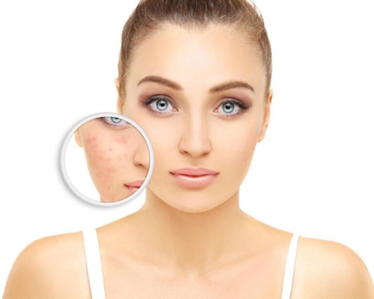 Tired of Dark Patches? Here's How to Remove Age Spots